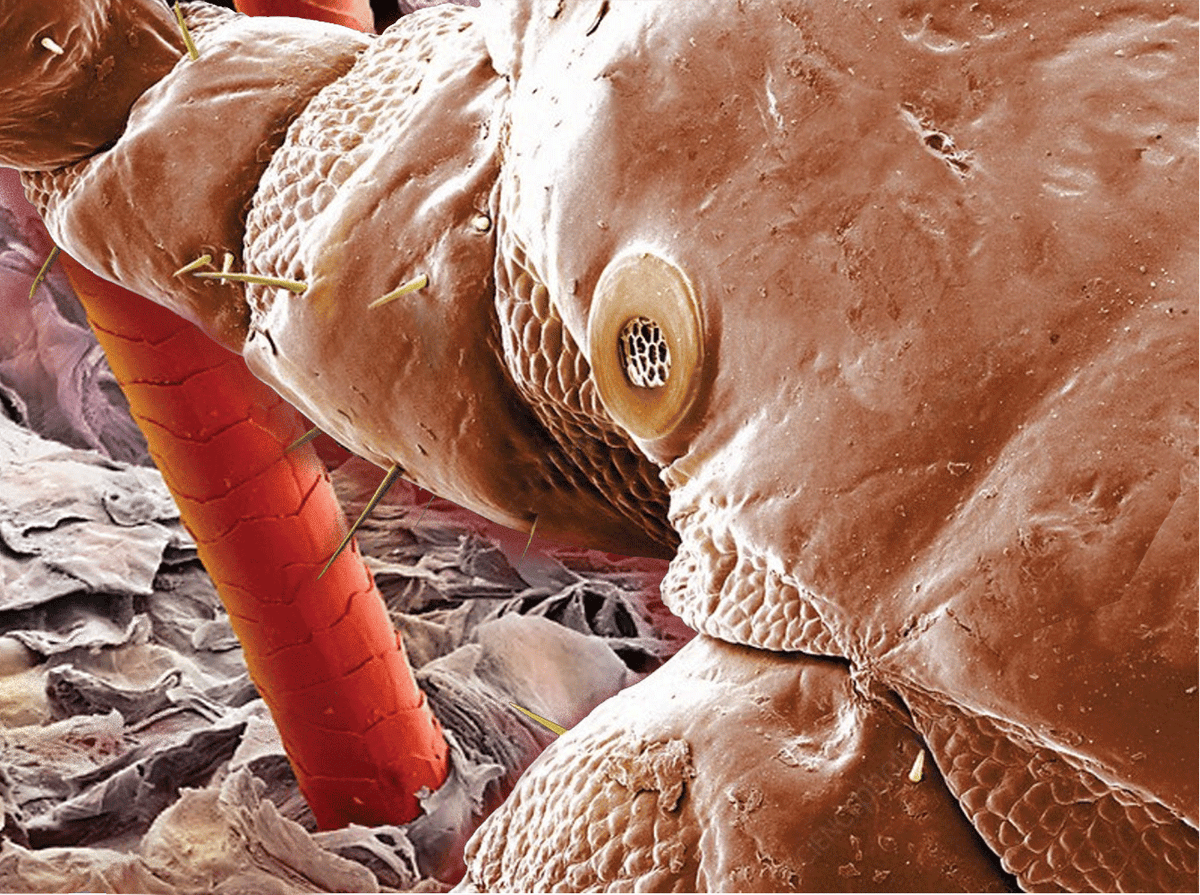 Headlice Spiracles